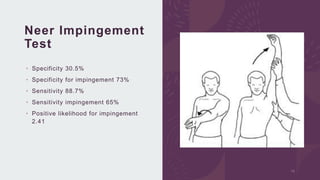 Shoulder Impingement - conservative management overview | PPT
