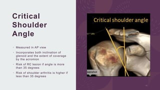 Shoulder Impingement - conservative management overview | PPT