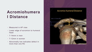 Shoulder Impingement - conservative management overview | PPT