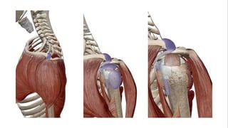 Shoulder Impingement - conservative management overview | PPSX