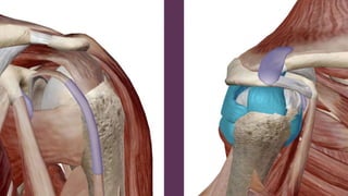 Shoulder Impingement - conservative management overview | PPT