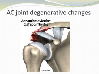 Anatomy and Biomechanics of shoulder complex | PPTX