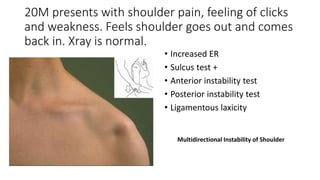 Shoulder.pptx