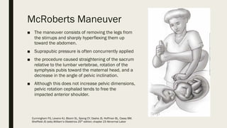 shoulder-dystocia.pdf