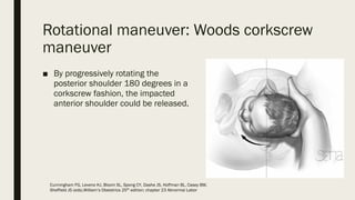 shoulder-dystocia.pdf