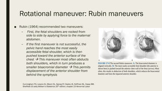 shoulder-dystocia.pdf