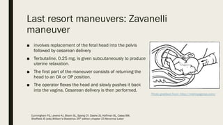 shoulder-dystocia.pdf