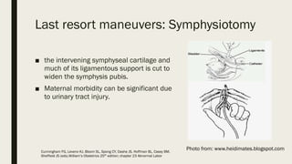 shoulder-dystocia.pdf