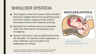 shoulder-dystocia.pdf