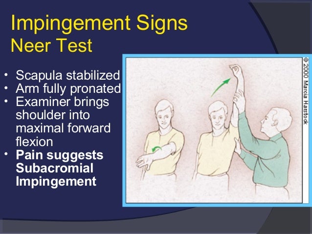 Neer Test Rotator Cuff