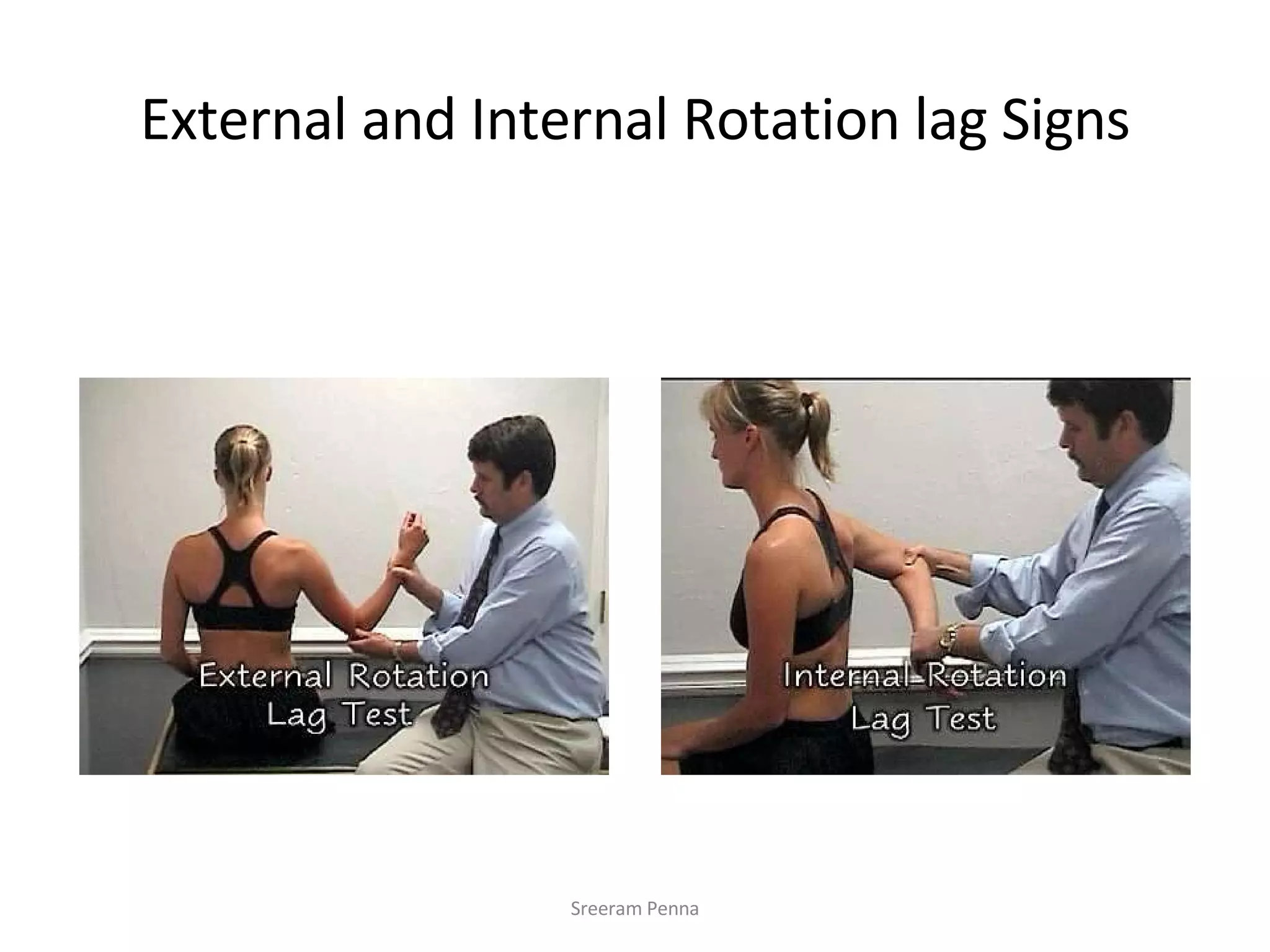 Shoulder Examination | PPT