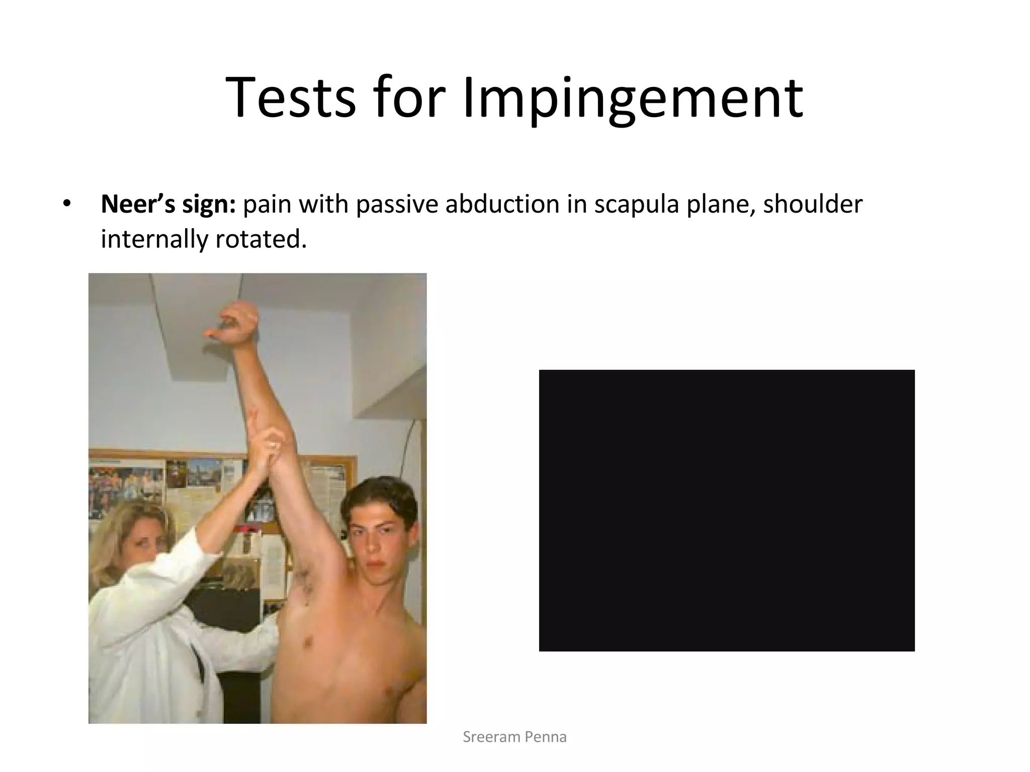 Shoulder Examination | PPT