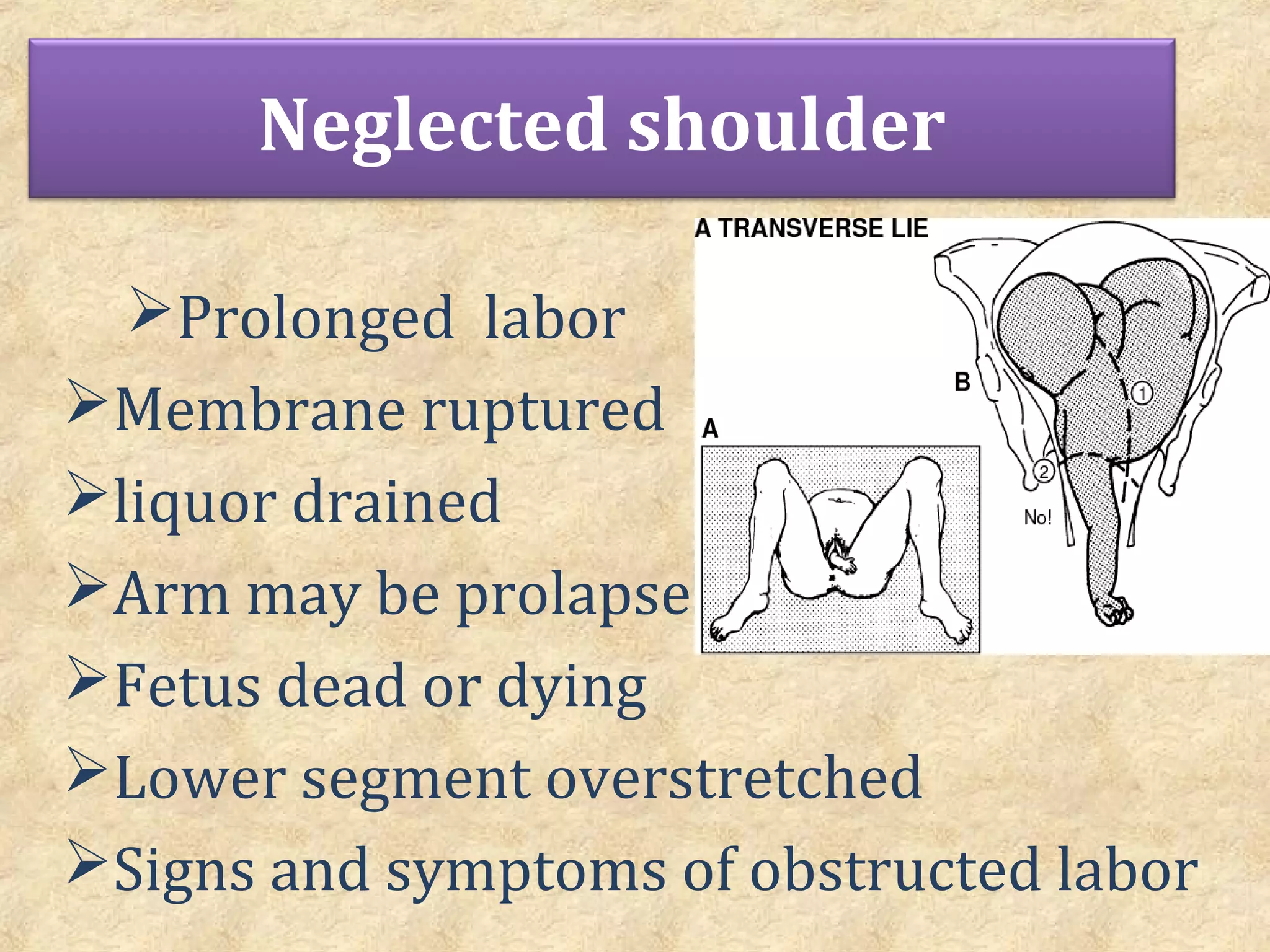 Shoulder presentation | PPT