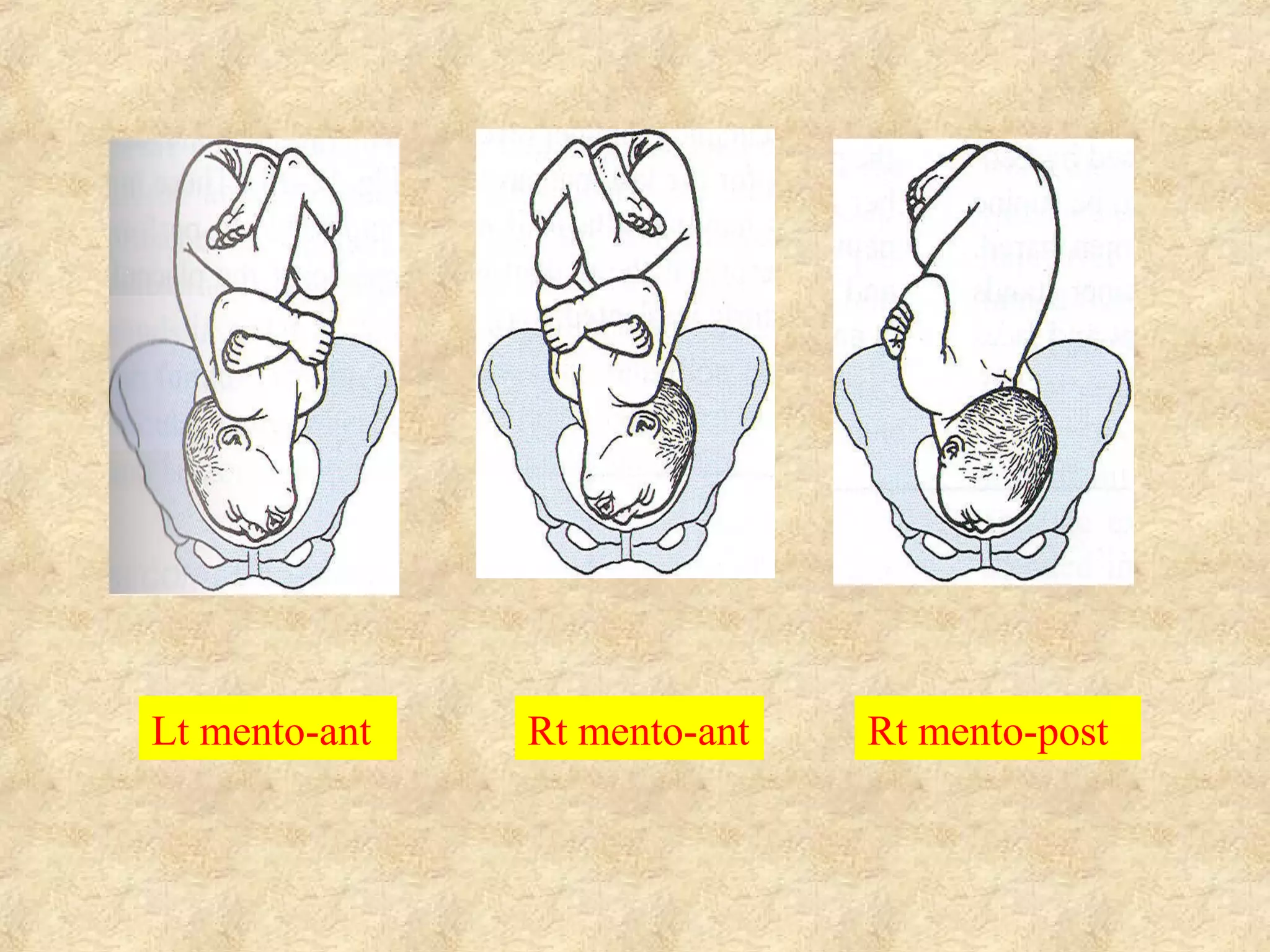 Shoulder presentation | PPT
