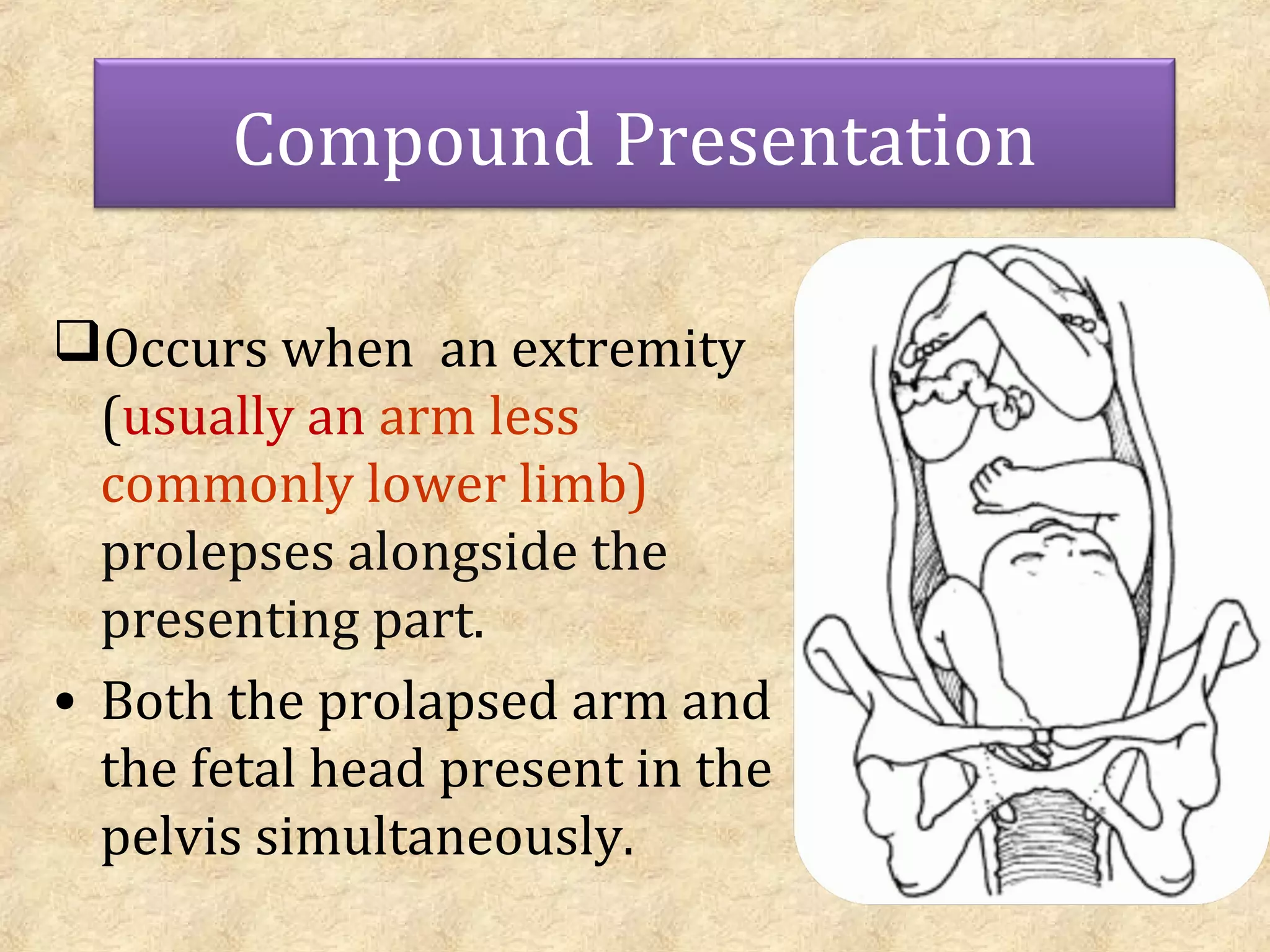 Shoulder presentation | PPT