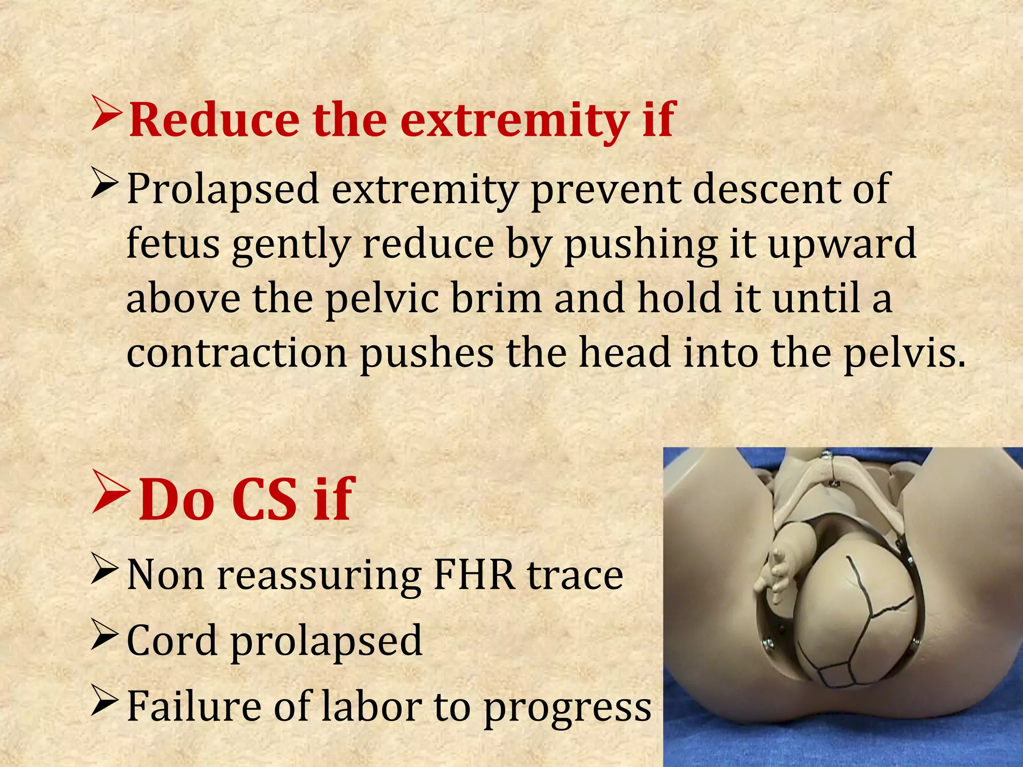 Shoulder presentation | PPT