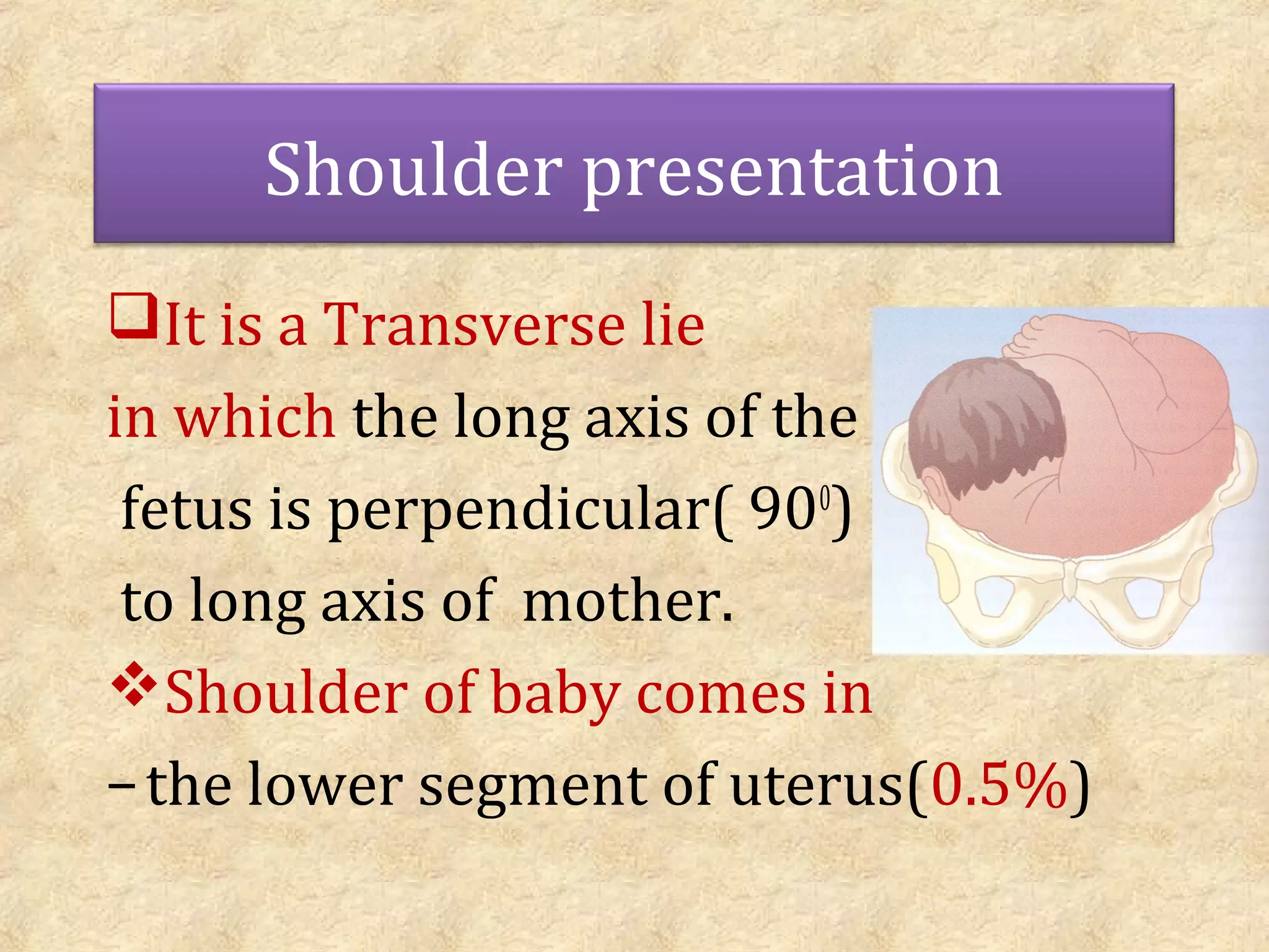 Shoulder presentation | PPT