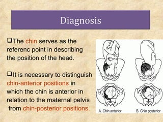 Shoulder presentation | PPT