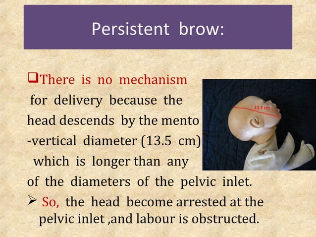Shoulder presentation | PPT | Pregnancy | Reproductive Health