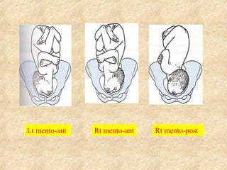 Shoulder Presentation