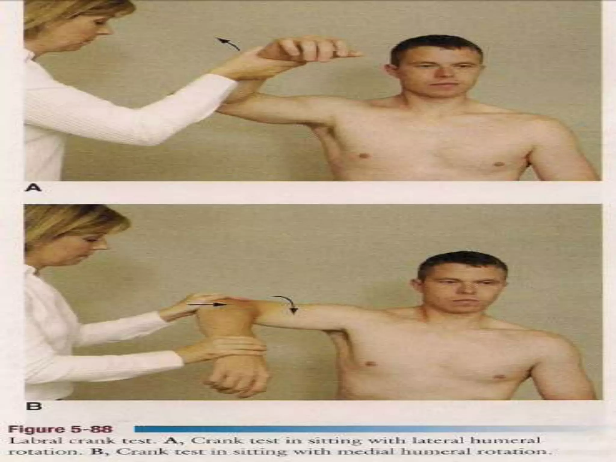 Shoulder - Special Tests | PPTX