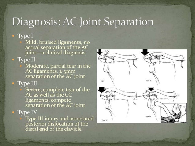AC Joint Separation | PPT