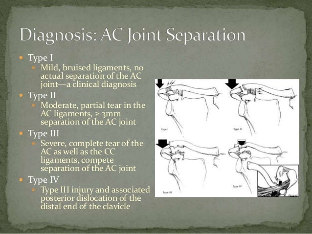 AC Joint Separation