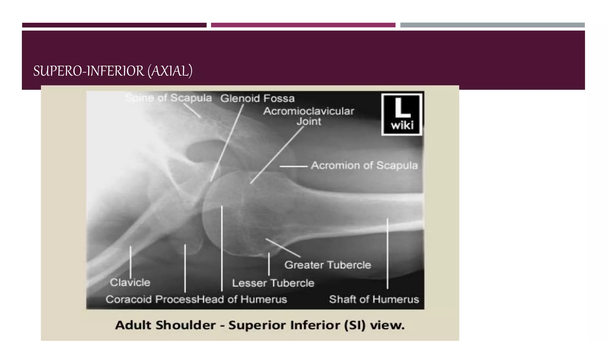 SHOULDER POSITIONING - ANAND GURMAITA ( BSc. RADIOLOGY ) | PPTX