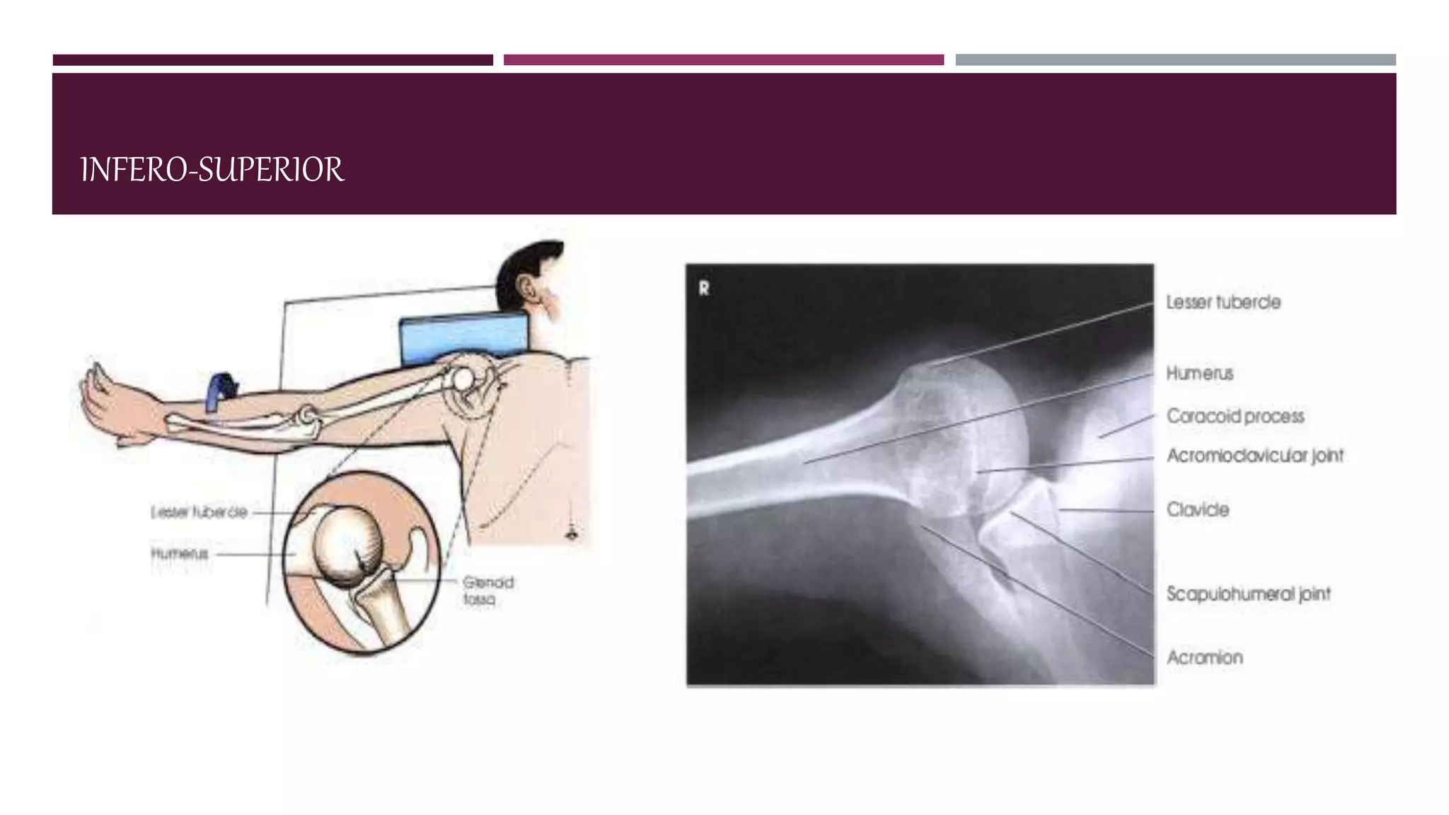 SHOULDER POSITIONING - ANAND GURMAITA ( BSc. RADIOLOGY ) | PPTX