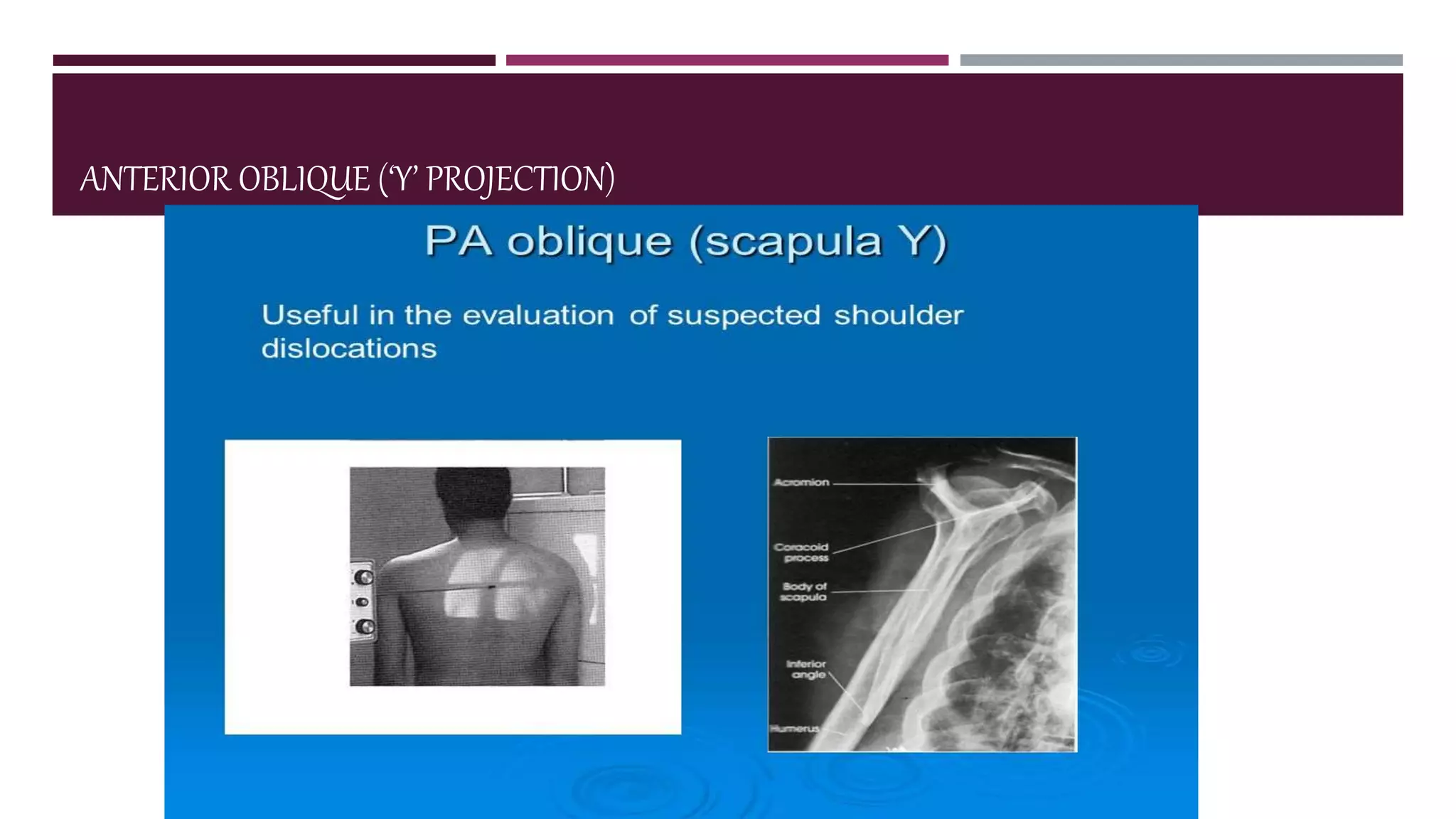 SHOULDER POSITIONING - ANAND GURMAITA ( BSc. RADIOLOGY ) | PPTX