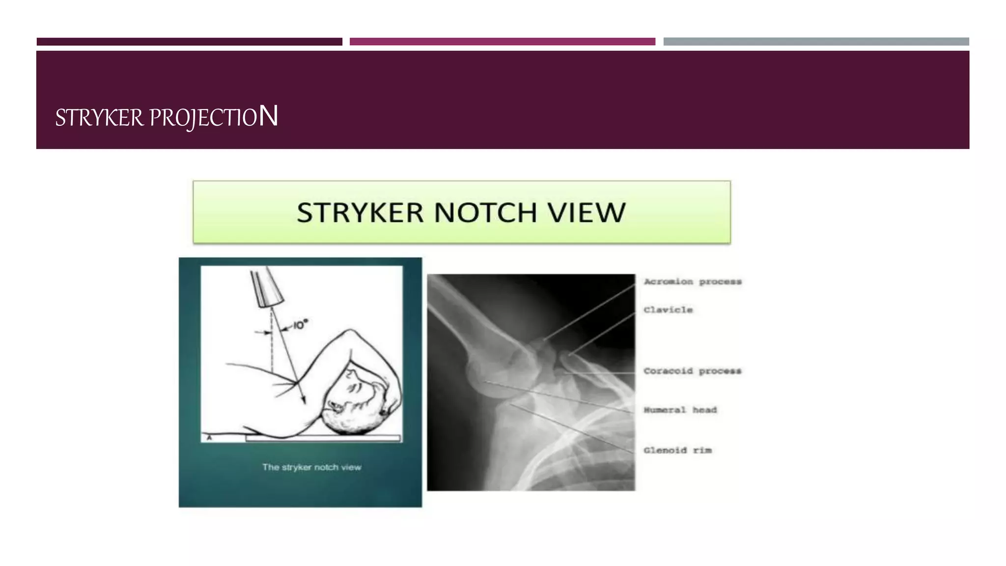 SHOULDER POSITIONING - ANAND GURMAITA ( BSc. RADIOLOGY ) | PPTX