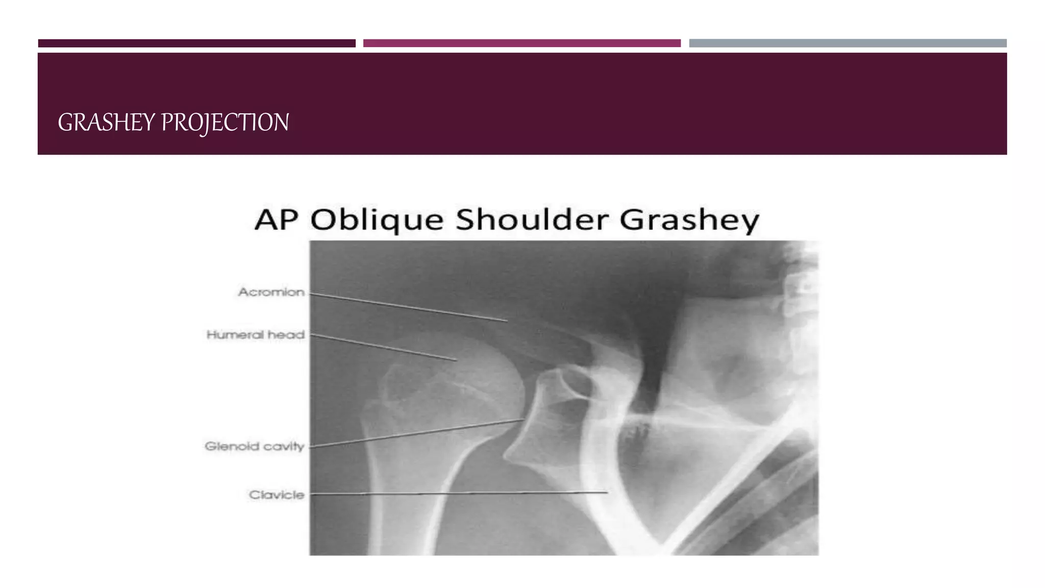 SHOULDER POSITIONING - ANAND GURMAITA ( BSc. RADIOLOGY ) | PPTX