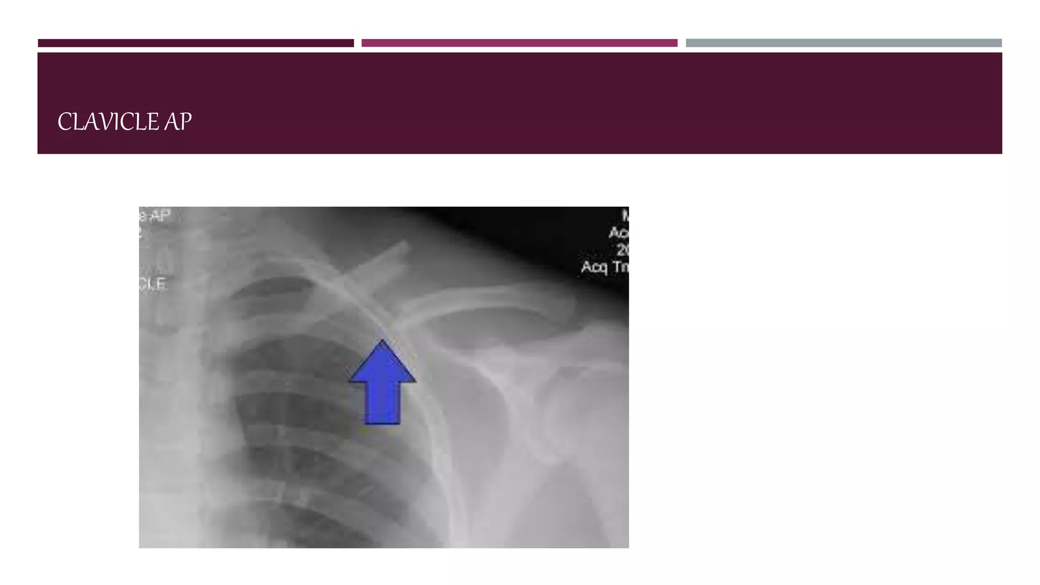 SHOULDER POSITIONING - ANAND GURMAITA ( BSc. RADIOLOGY ) | PPTX