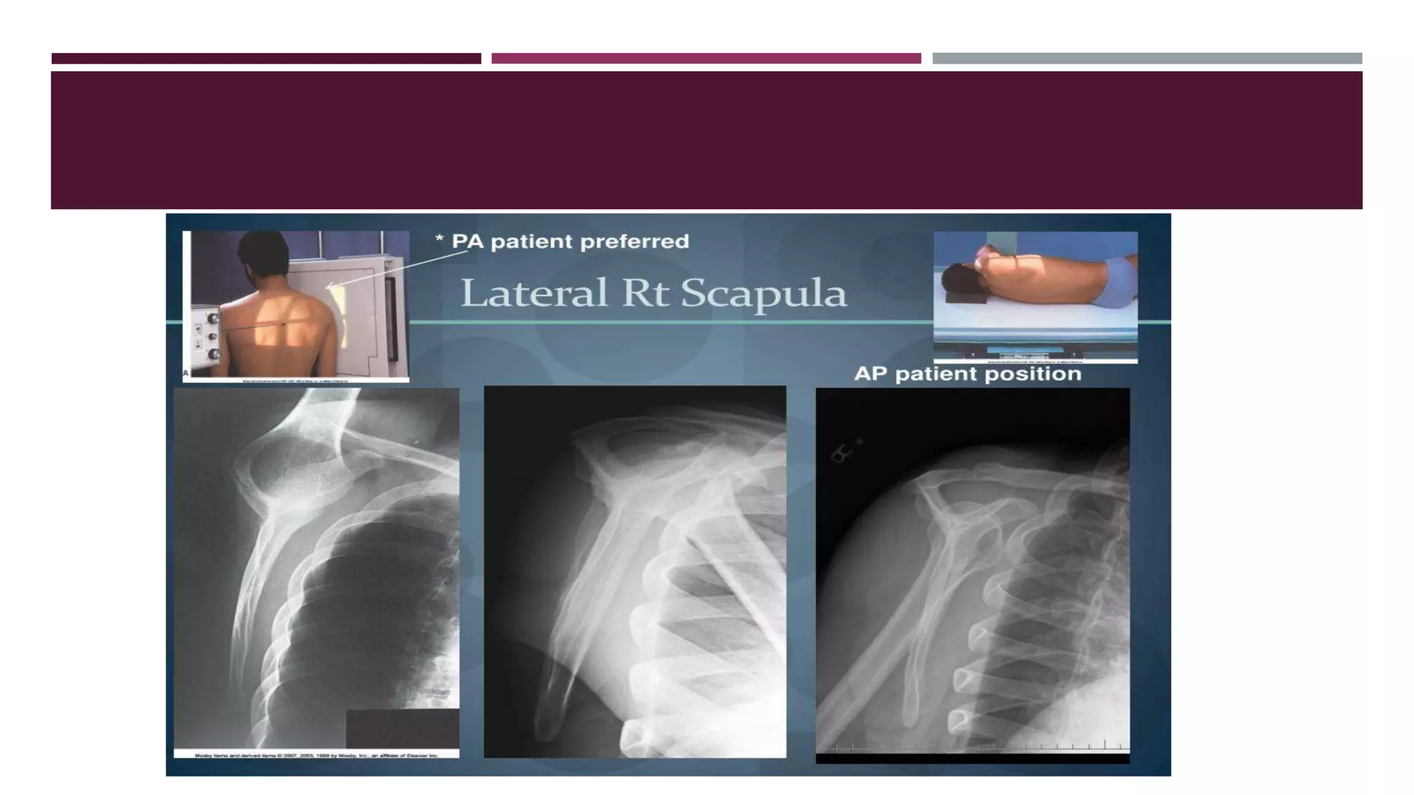 SHOULDER POSITIONING - ANAND GURMAITA ( BSc. RADIOLOGY ) | PPTX