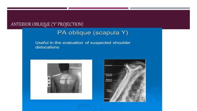 SHOULDER POSITIONING - ANAND GURMAITA ( BSc. RADIOLOGY ) | PPTX | Death ...
