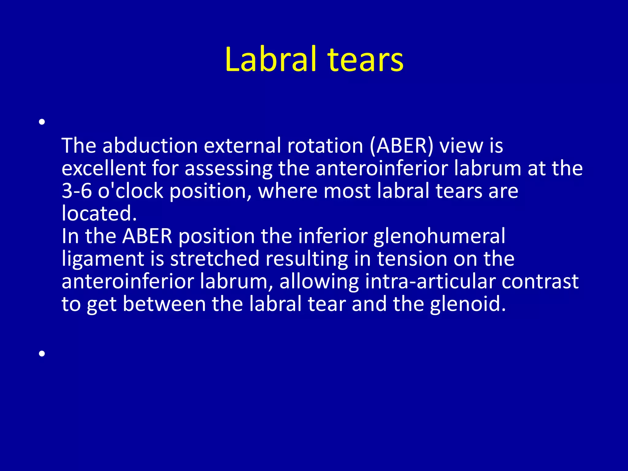 MRI of Shoulder anatomy | PPTX