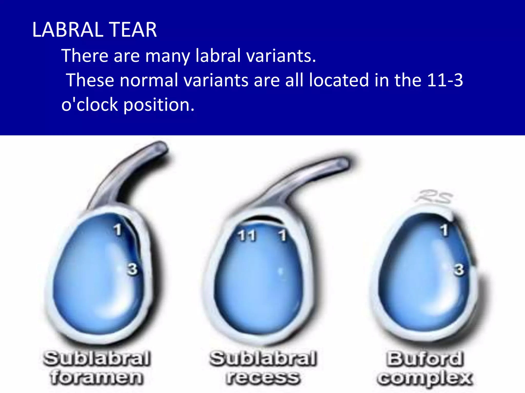 MRI of Shoulder anatomy | PPTX