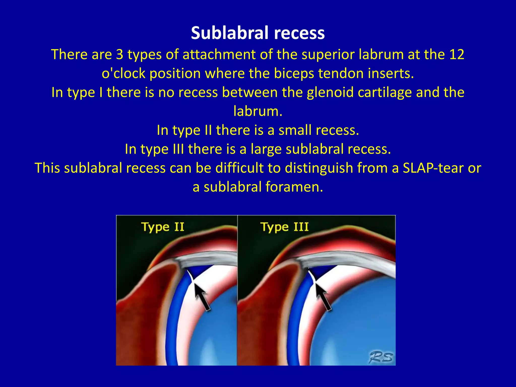 MRI of Shoulder anatomy | PPTX