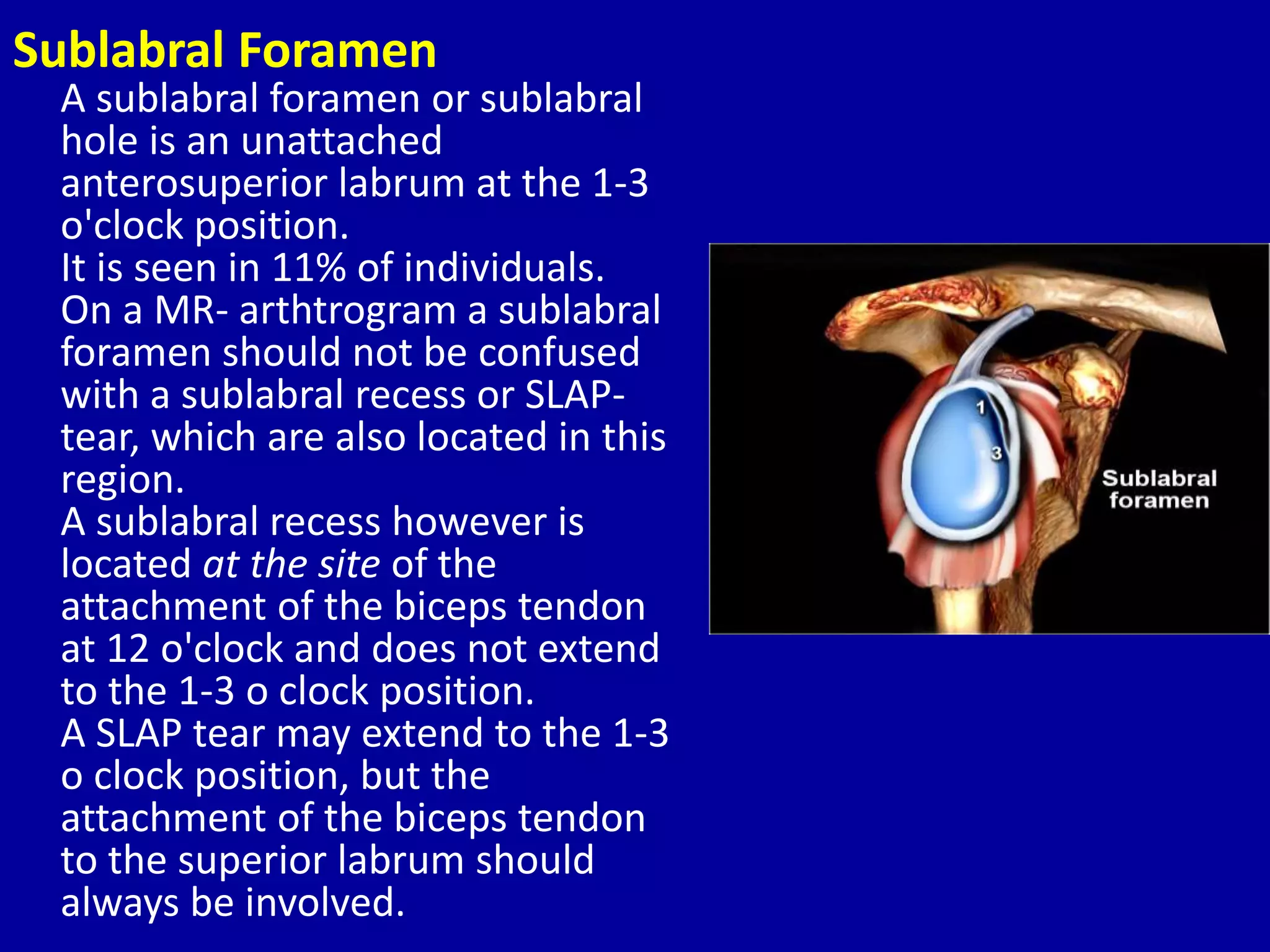 MRI of Shoulder anatomy | PPTX