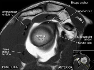MRI of Shoulder anatomy | PPTX