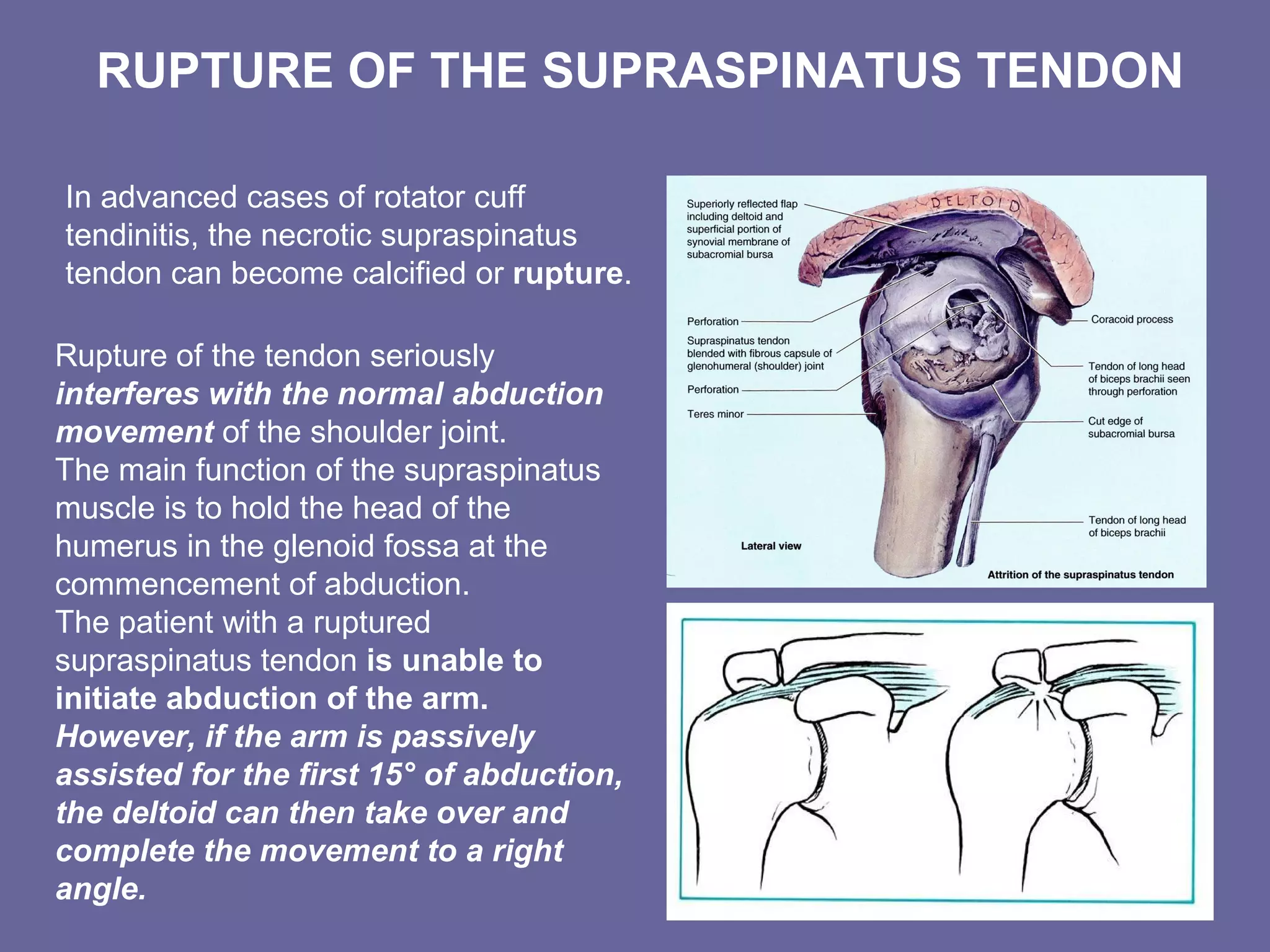 Shoulder anatomy | PPT