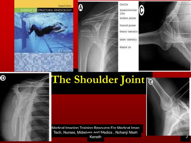 Shoulder anatomy . radiology training resource nchanaji nkeh keneth | PPT