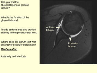 shoulder_anatomy_166103_284_41995_v1.ppt