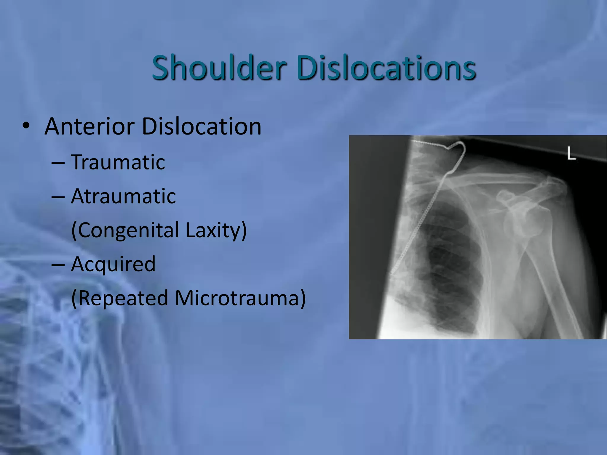 Shoulder anatomy & examination-2.pptx