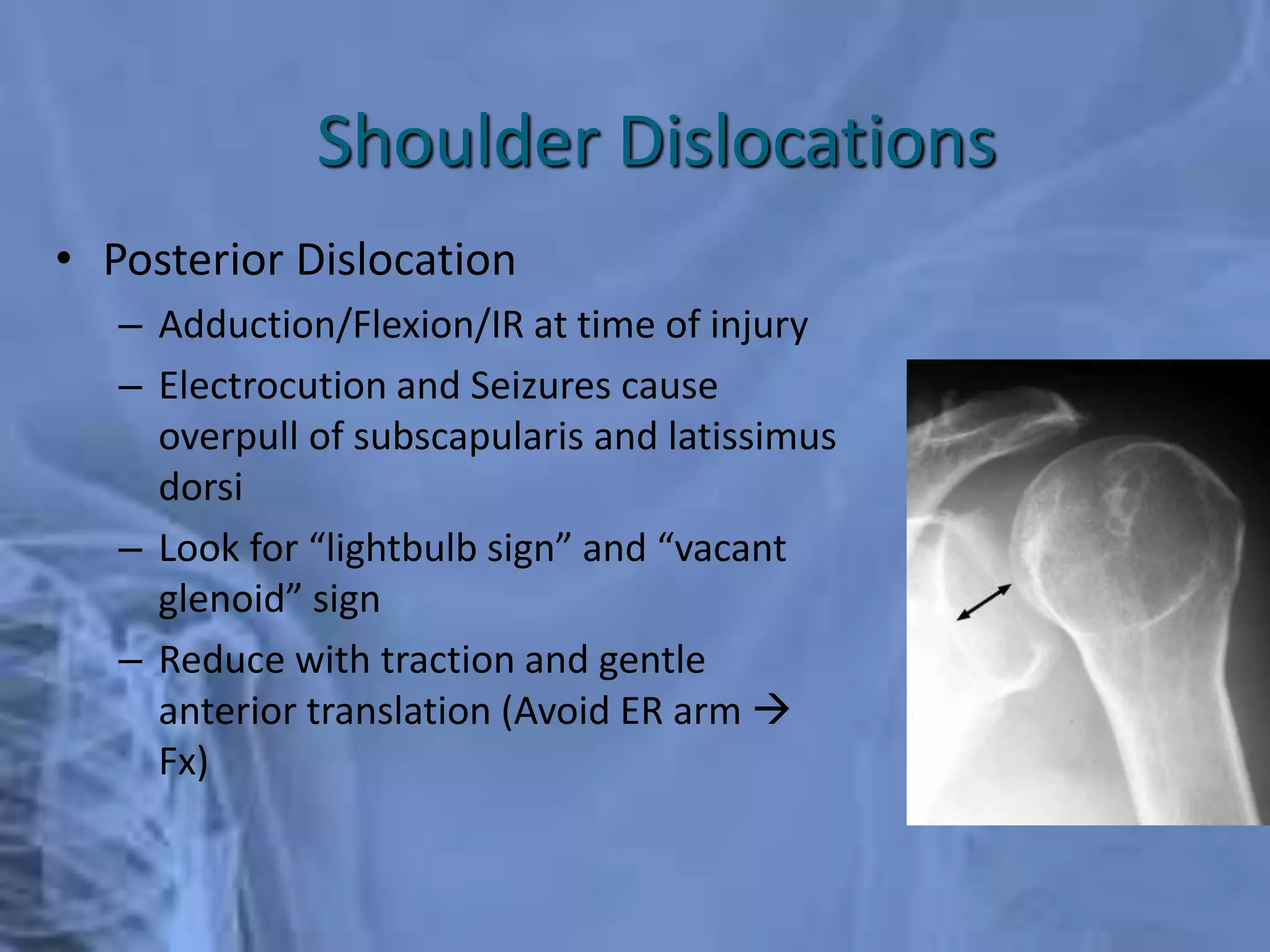 Shoulder anatomy & examination-2.pptx