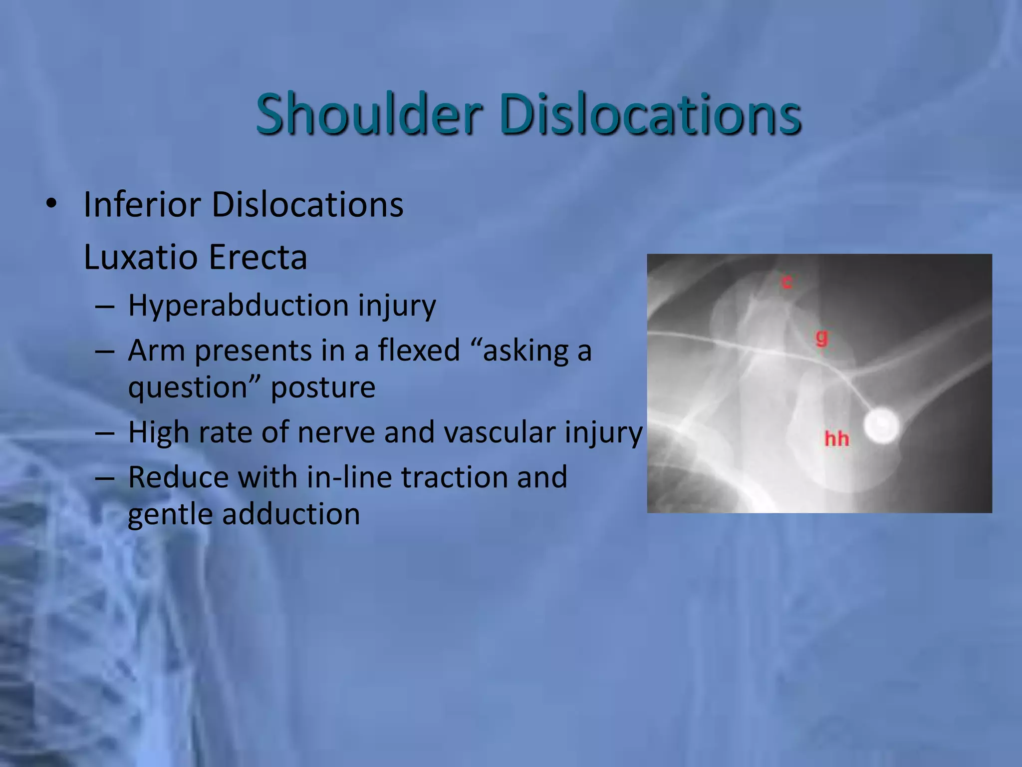 Shoulder anatomy & examination-2.pptx