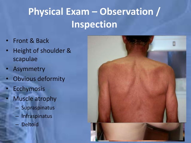 Shoulder anatomy & examination-2.pptx