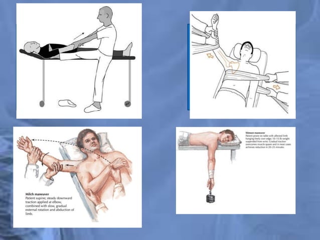 Shoulder anatomy & examination-2.pptx