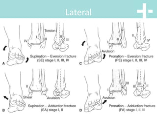 Shoulder and ankle instability | PPTX