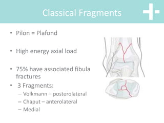 Shoulder and ankle instability | PPT